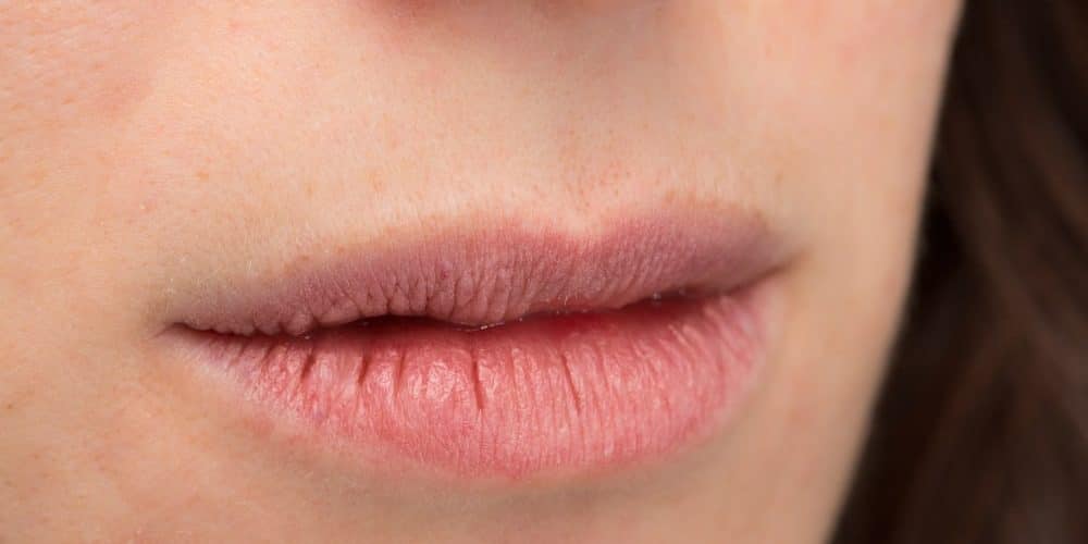 Como acabar de vez com lábios ressecados